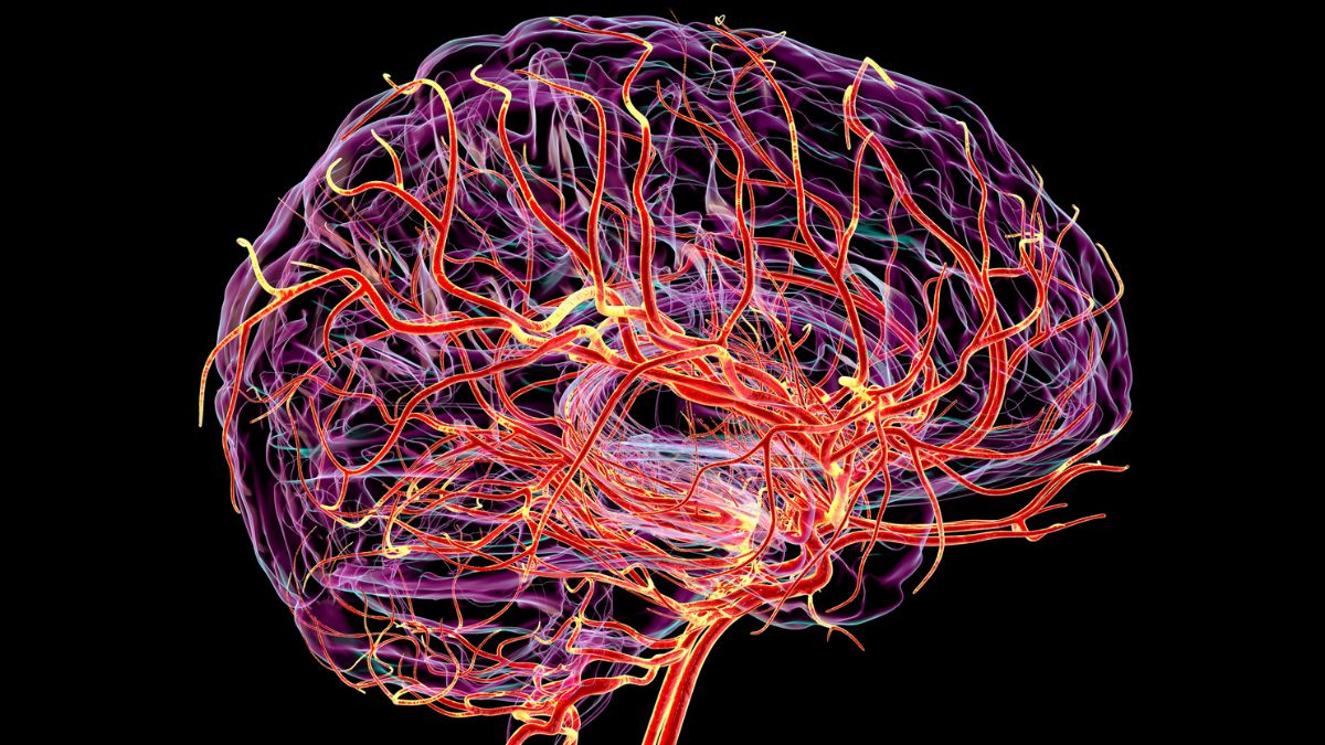 How Blood Flow Problems in Your Brain Can Trigger Vascular Dementia